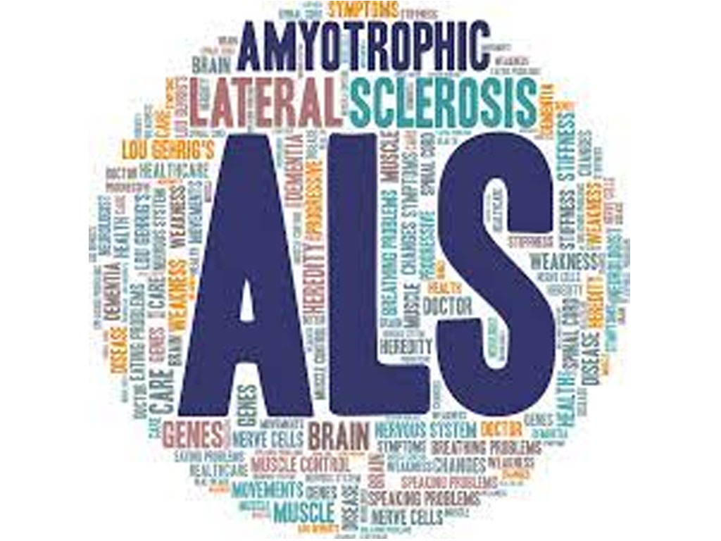 Mengenal Amyotrophic Lateral Sclerosis (ALS) Penyakit Saraf yang ... Mengenal Amyotrophic Lateral Sclerosis (ALS) Penyakit Saraf yang ...