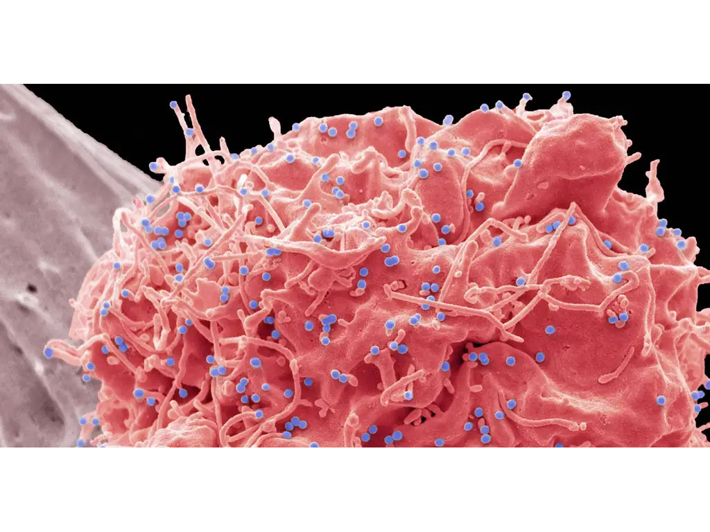 Ini yang Perlu Diketahui Tentang Obat HIV dalam Bentuk Suntikan | Tagar